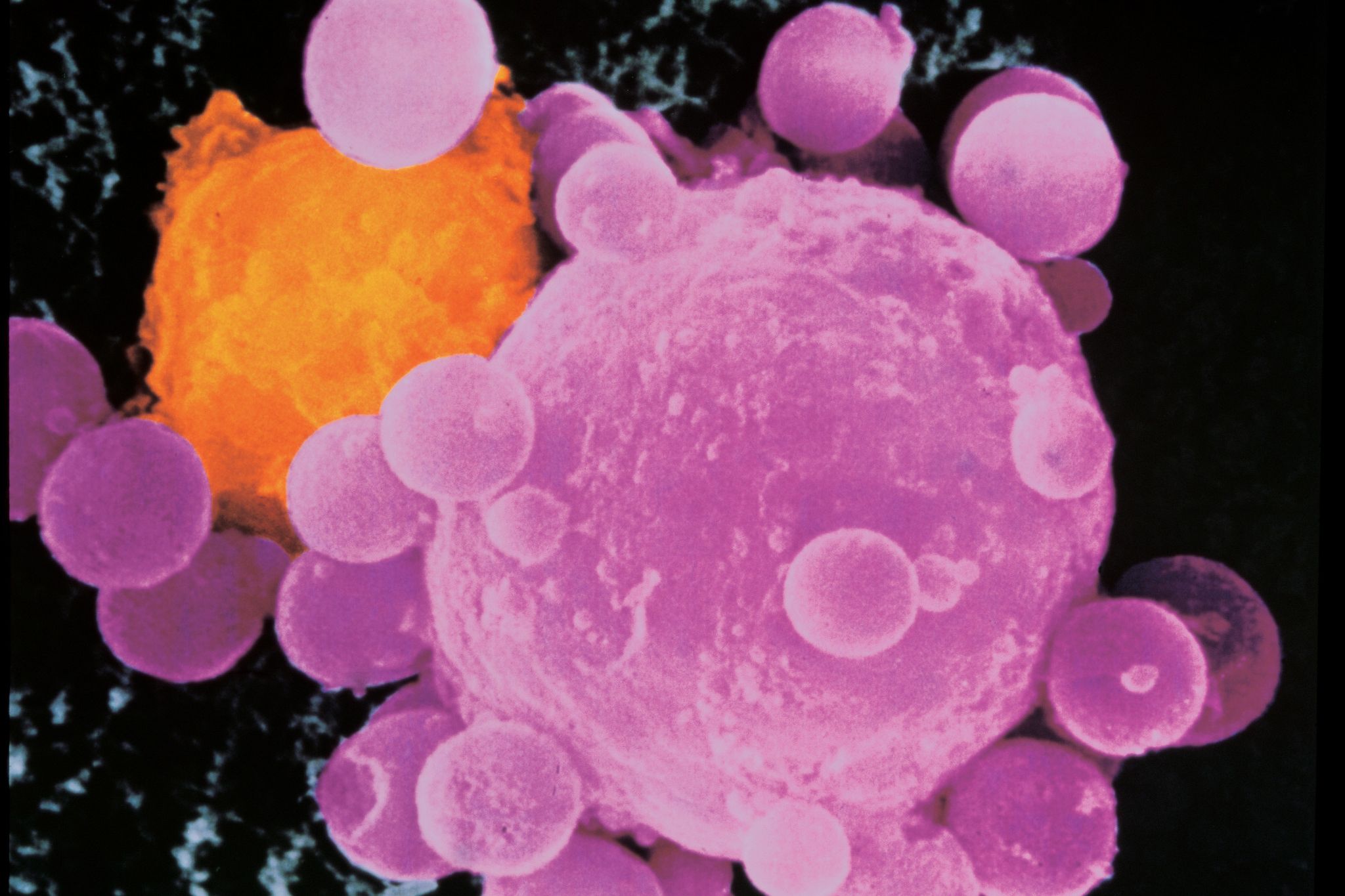 Cancer Cachexia Model | Charles River