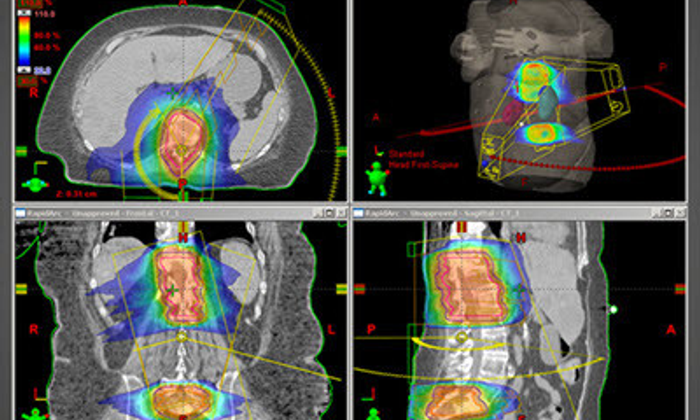Treatment planning | Varian