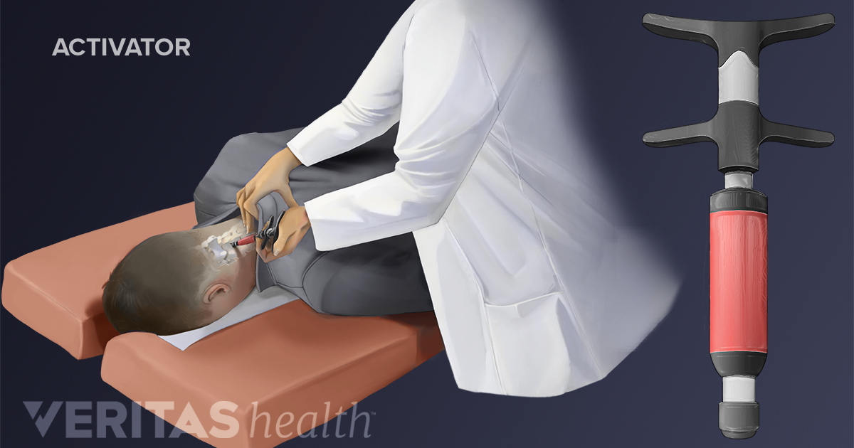Activator Method Efficacy And Risks 2597