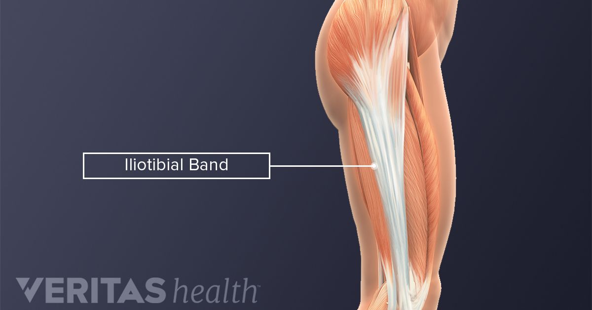 It Band Syndrome Symptoms