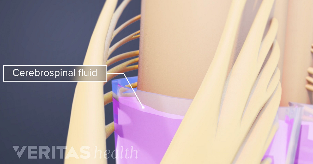 Cerebrospinal Fluid Definition | Back Pain and Neck Pain Medical Glossary Cerebrospinal Fluid Definition | Back Pain and Neck Pain Medical Glossary