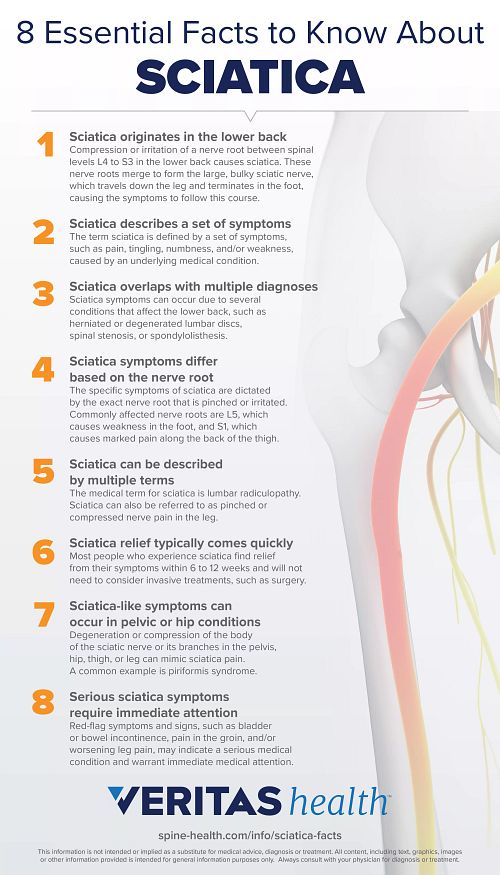 Types of Sciatic Nerve Pain Types of Sciatic Nerve Pain