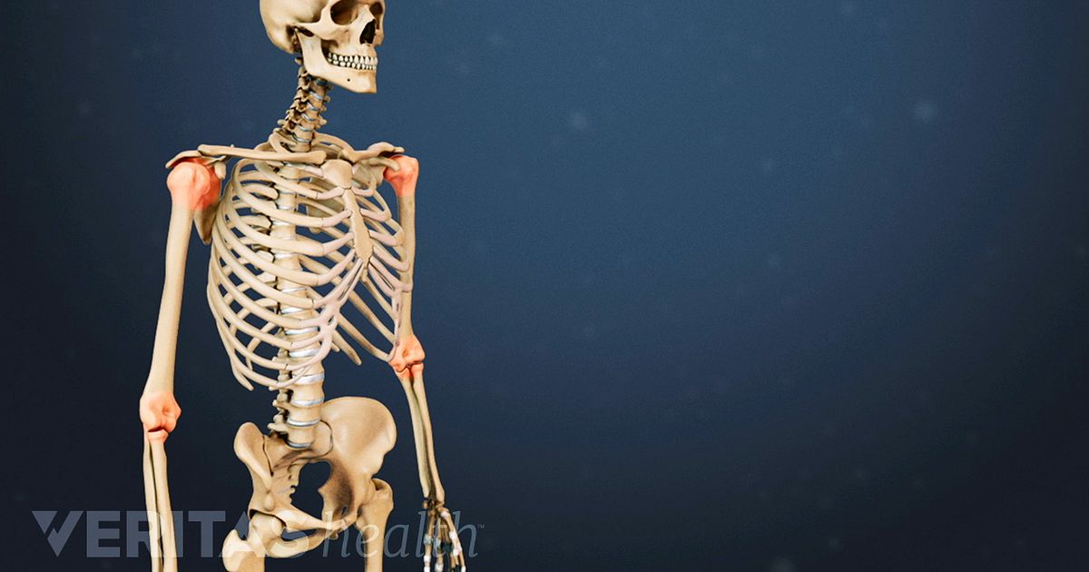 Rheumatoid Arthritis In The Spine